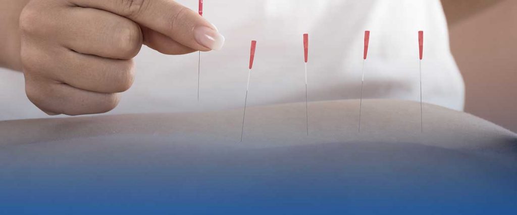 Acupuncture Treatment Plans - Real-ease Massage Therapy